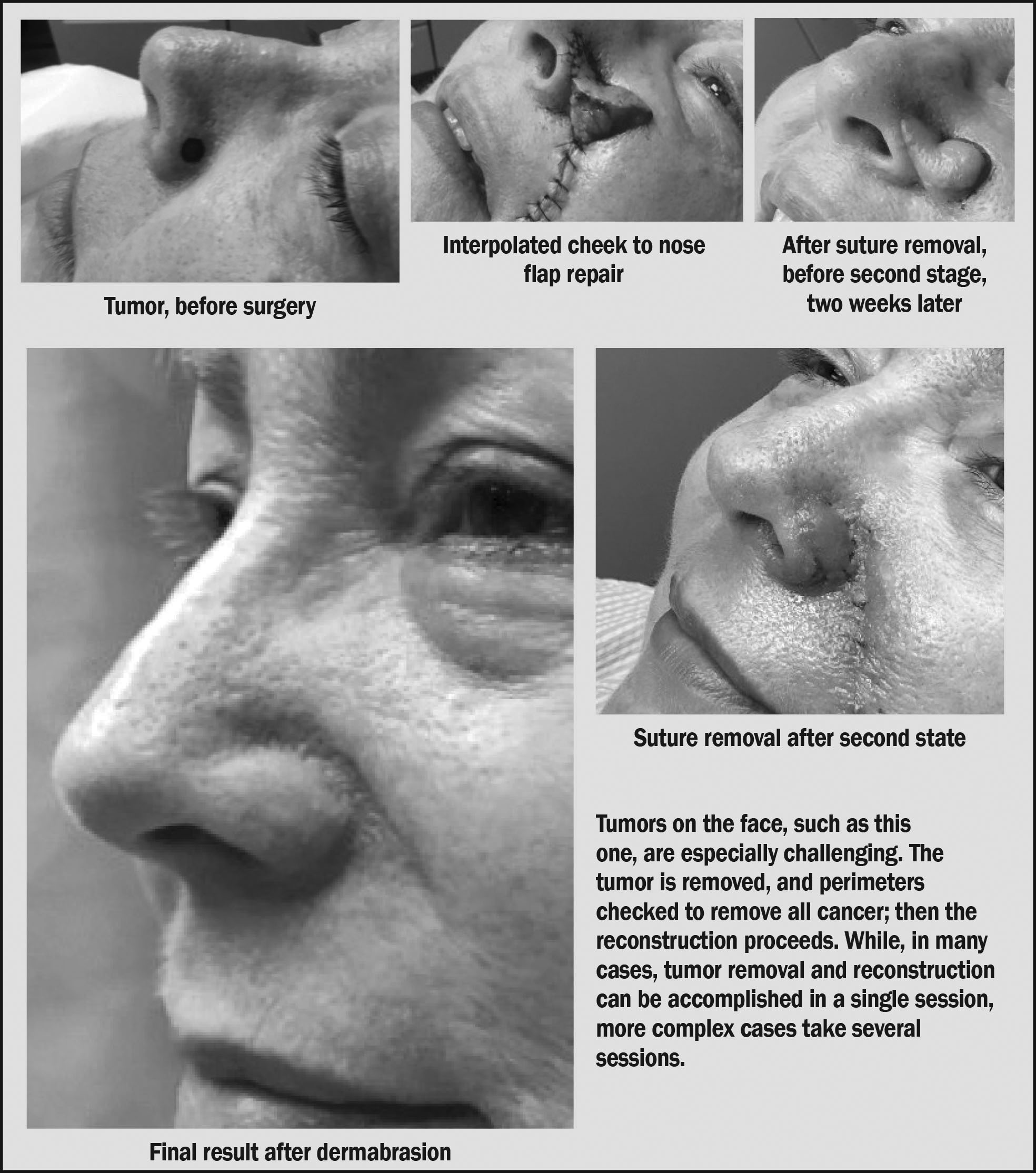 Repairing the Ravagesof Skin Cancer - Health & Healing