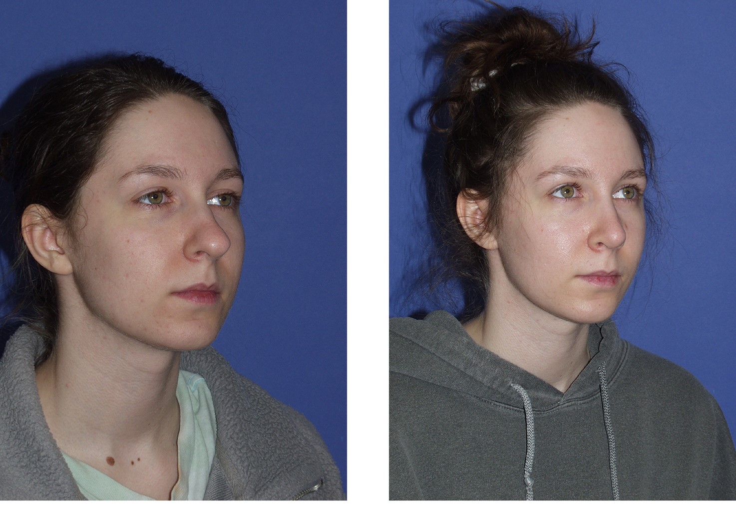 Facial Plastic Surgery: A Healing Response to Personal Health ...